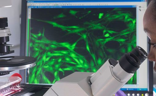 Biotechnology In Textiles, Global Enzyme Market, Biostoning Of Denim ...