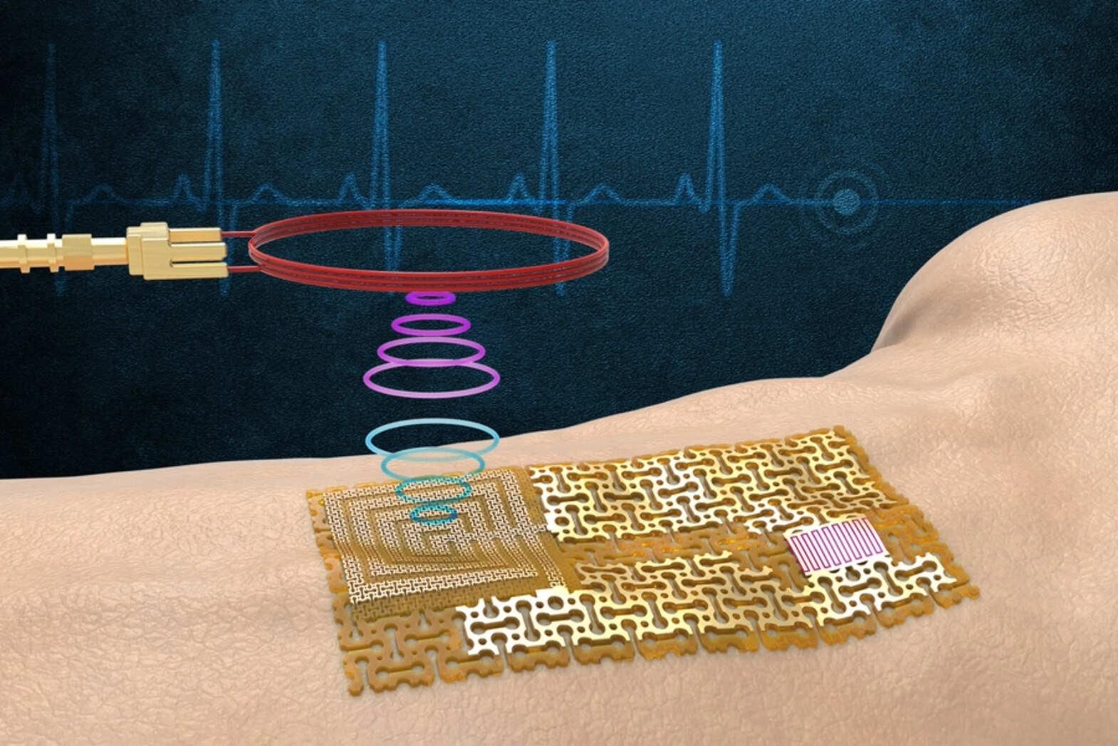 Wearable Electronic Skin: The Future of Health Monitoring